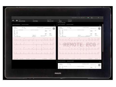 Cardiac Workstation | Coffey Medical